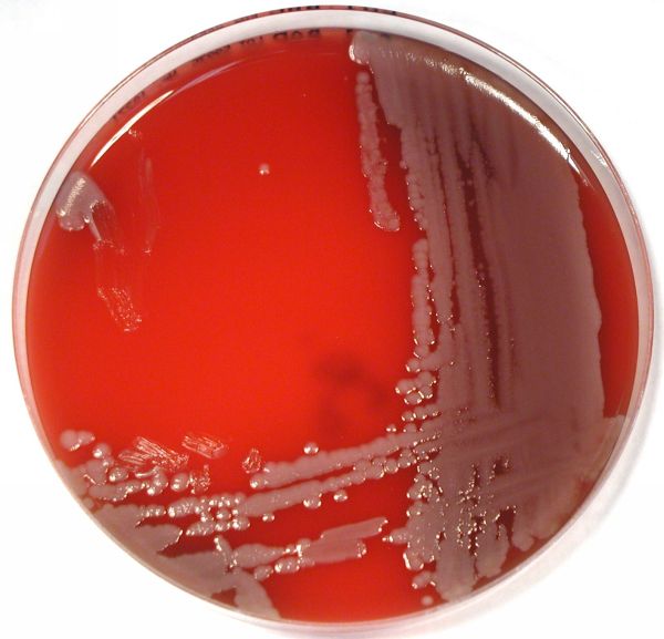 Acinetobacter Infection