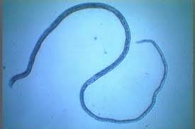 Capillariasis | Spain| PDF | PPT| Case Reports | Symptoms | Treatment