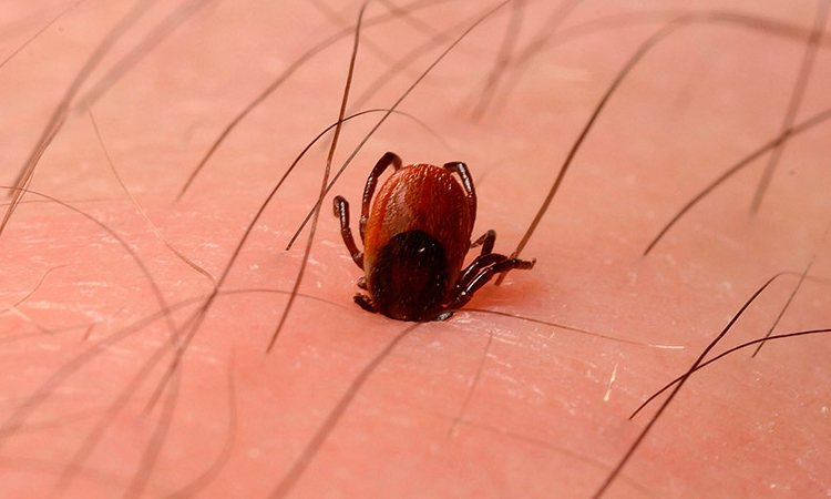 Colorado Tick Fever | Australia | PDF | PPT| Case Reports | Symptoms ...